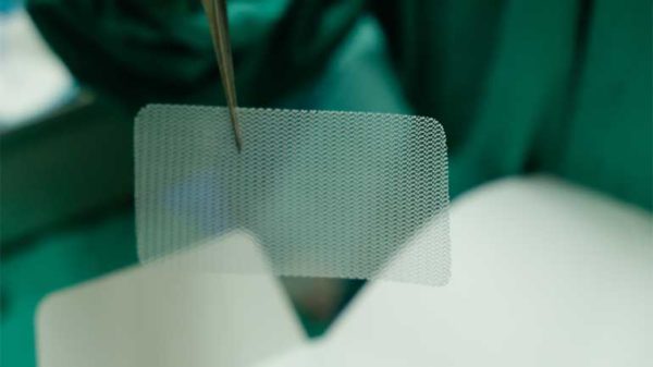 Have you experienced a Hernia Mesh complication?
